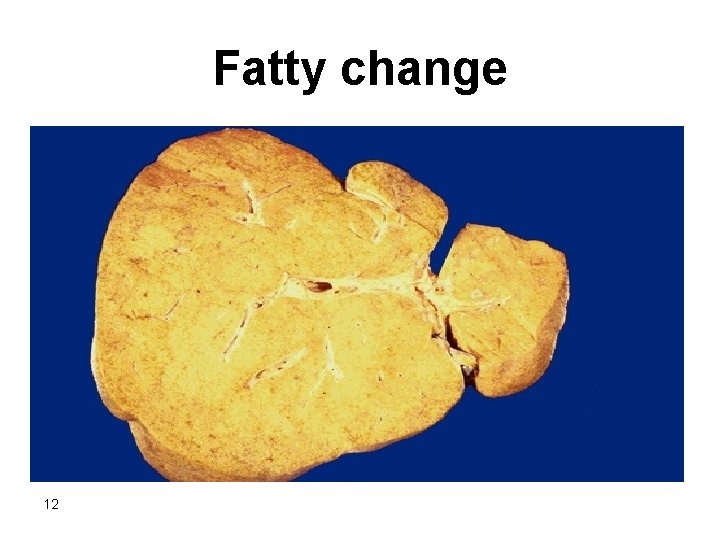 Liver 1 Function 1 Metabolic Glucose 2 Synthetic