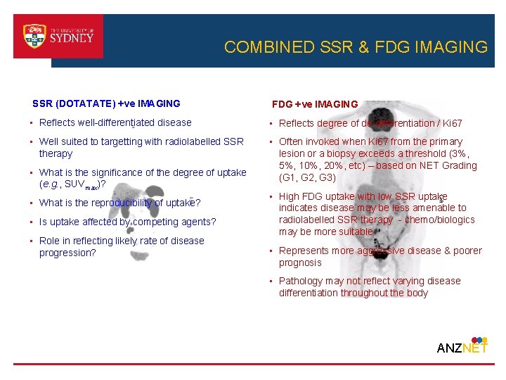 A GRADING SCHEME FOR COMBINED SOMATOSTATIN RECEPTOR SSR