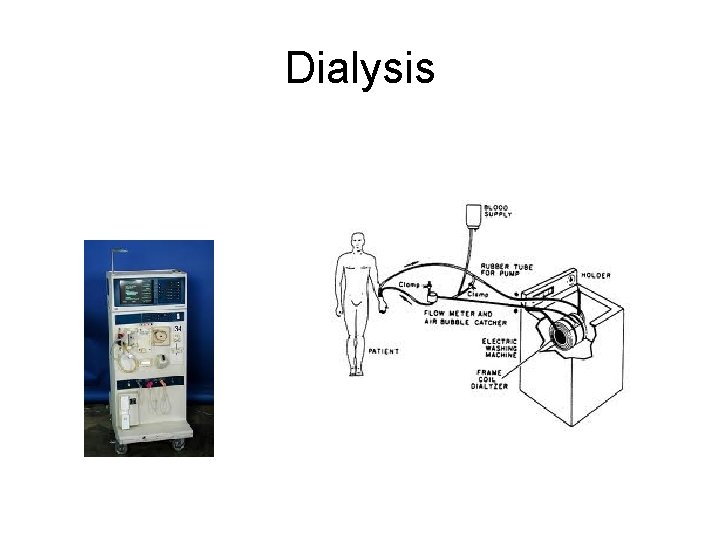 Digestion Notes Where Digestion begins in the mouth