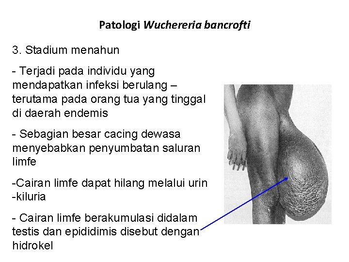 NEMATODA JARINGAN enterobius vermicularislla trichinella spiralis ...