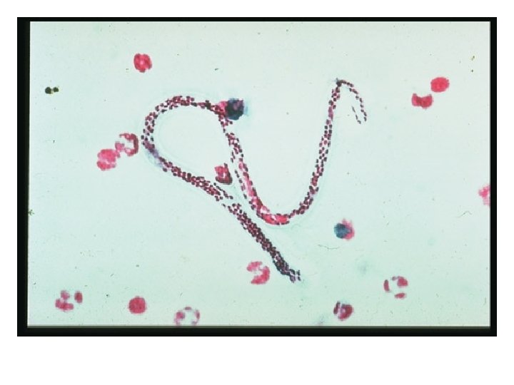 NEMATODA JARINGAN enterobius vermicularislla trichinella spiralis ...