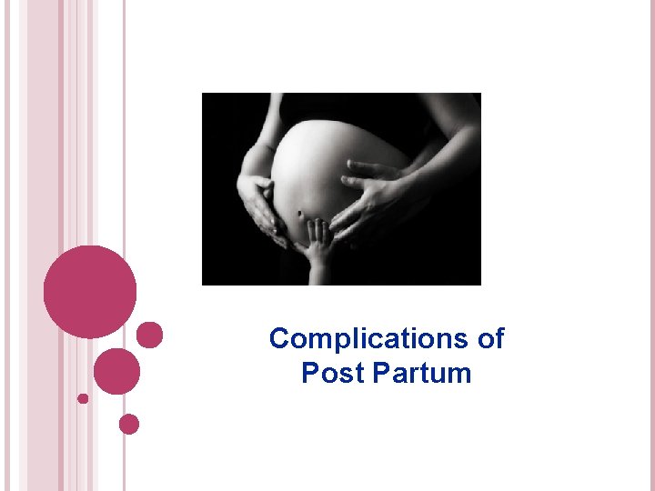 Complications of Post Partum POSTPARTUM HEMORRHAGE Early Occurs