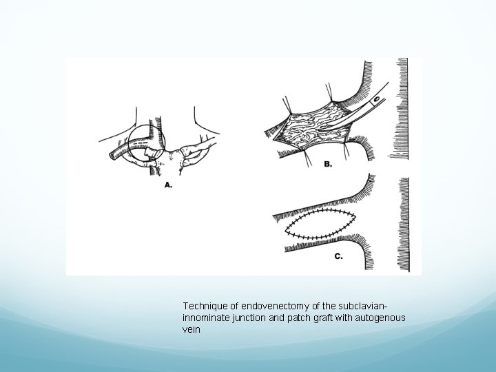 NECK1 CLASS 10 15092015 ANATOMY OF THE THORACIC