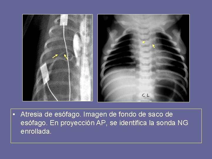 UTILIZACION DE CONTRASTES VIA ENTERAL EN EL PACIENTE