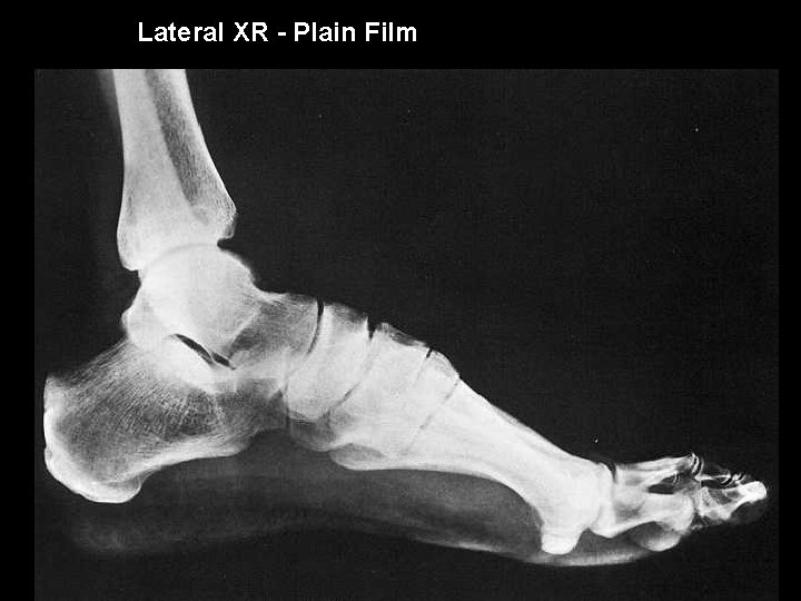 PA XR Plain Film Lateral XR Plain Film