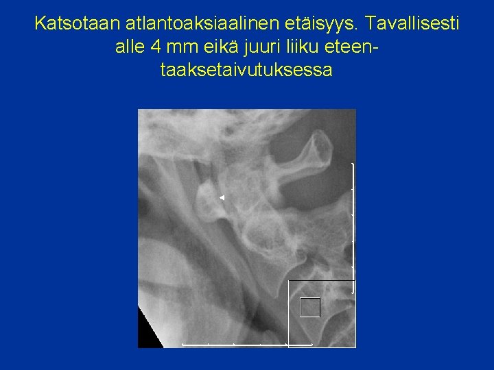 Eitraumaattisten luun ja nivelten sairauksien radiologinen ...