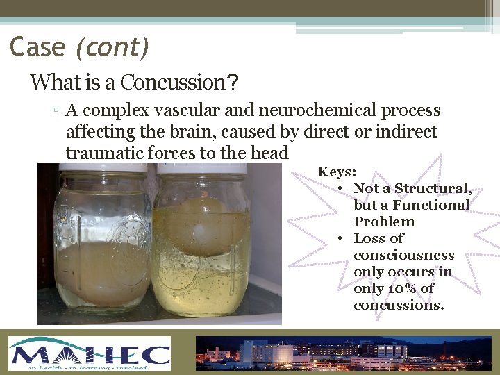 Concussion EvidenceBased Blueprint for Success Aaron Vaughan MD