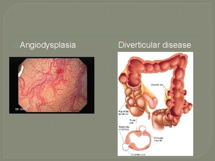 Taking the gastrointestinal history Dr J A Coetser