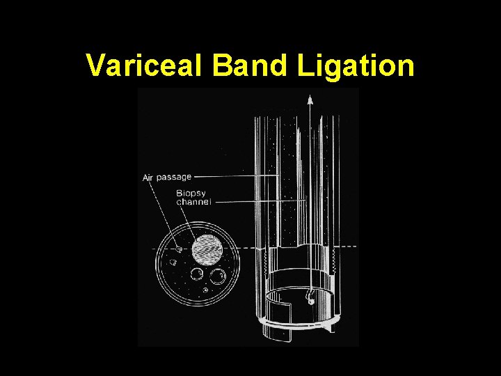 Acute Gastrointestinal Bleeding Rajeev Jain M D GI