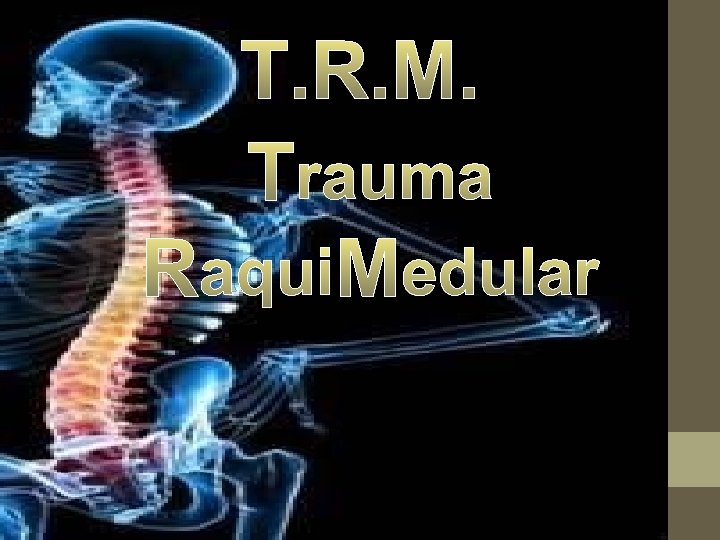 T R M Trauma Raqui Medular ANATOMIA DE