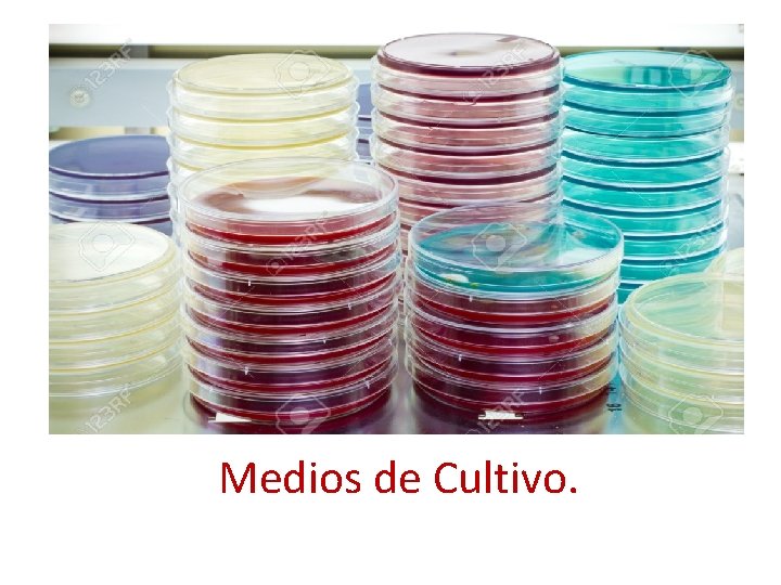 Medios de Cultivo Debemos de tener en cuenta