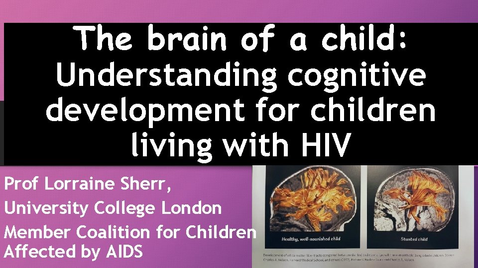 The brain of a child Understanding cognitive development
