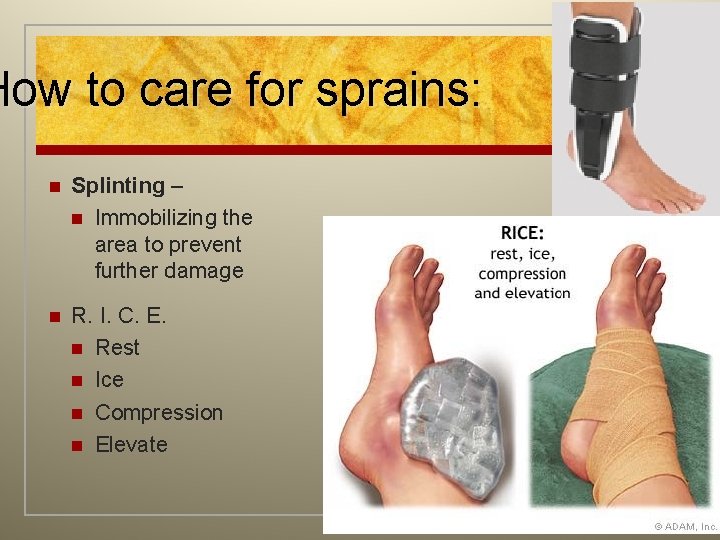 First Aid Accident Prevention Ms Snyder Sprains vs