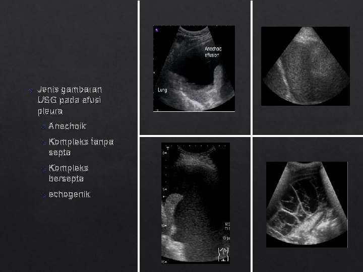 WEBINAR Transthoracic US of the Chest Clinical Uses