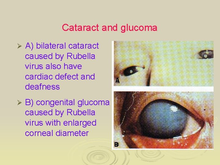 Patterns of Congenital Abnormalities Lecturer of Experimental Embryology