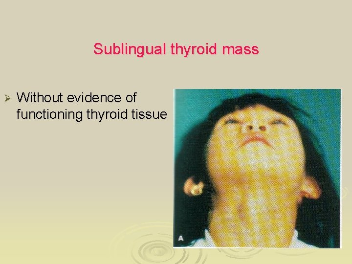 Patterns of Congenital Abnormalities Lecturer of Experimental Embryology