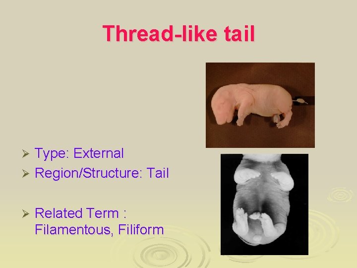 Patterns of Congenital Abnormalities Lecturer of Experimental Embryology