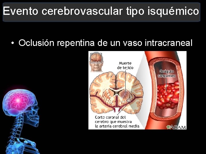 Enfermedad cerebrovascular FisiopatologaUNIBE Dra Yazmn Mora Cambronero ...