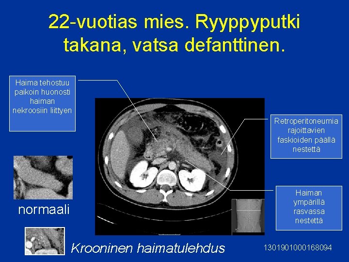 Gastro ja urokuvantaminen Petri Sipola kliininen opettaja Kuopion
