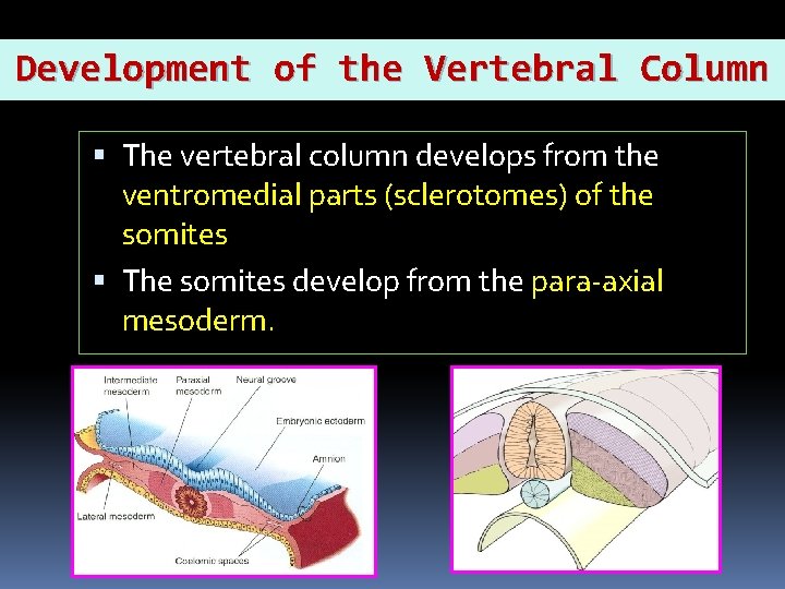 Development of Spinal Cord Vertebral Column Dr Sanaa