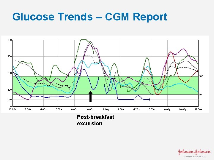 Continuous Glucose Monitoring Diabetes Management Evolution Urine Testing