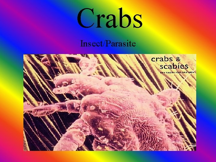 Sexually Transmitted Infections Crabs InsectParasite ...