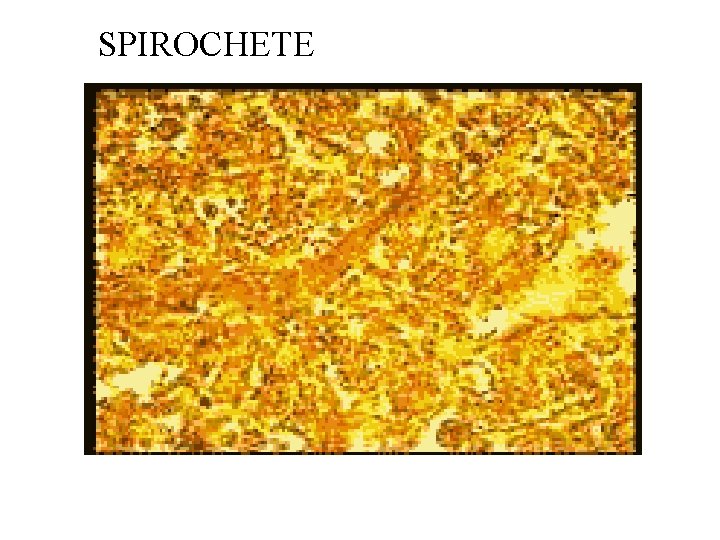 Sexually Transmitted Infections Crabs InsectParasite ...