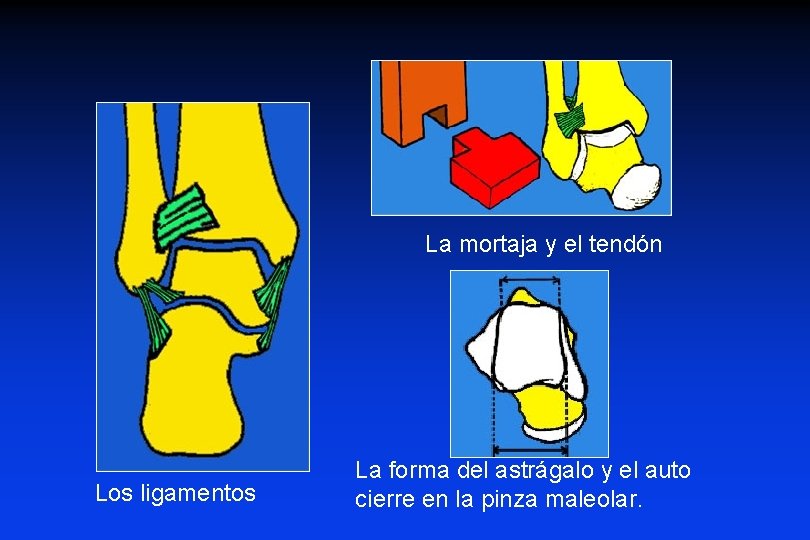 Traumatologa del Tobillo La mortaja y el tendn