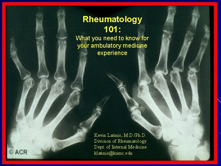 Rheumatology 101 What you need to know for