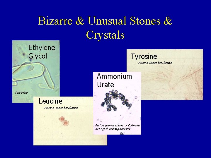 Pediatric Stone Disease Overview Epidemiology 4 Reasons Stones