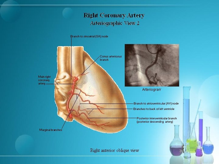 Cardiac CT Angiography Heart anatomy Atherosclerosis SIEMENS SOMATOM