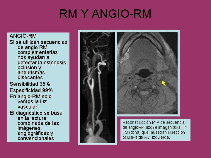 TECNICAS DE IMAGEN EN LA DISECCION DE LA