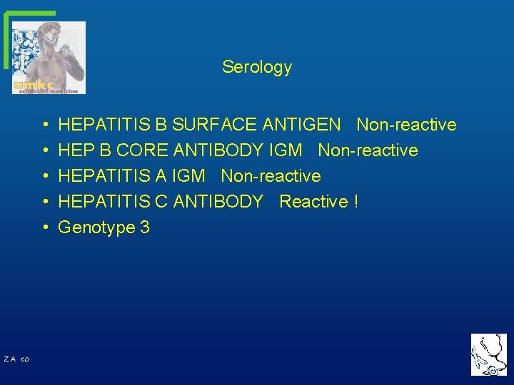 Facts are stubborn but statistics are more pliable