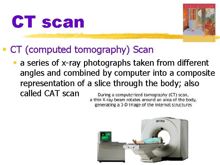 Ways to study the Brain z Accidents damage