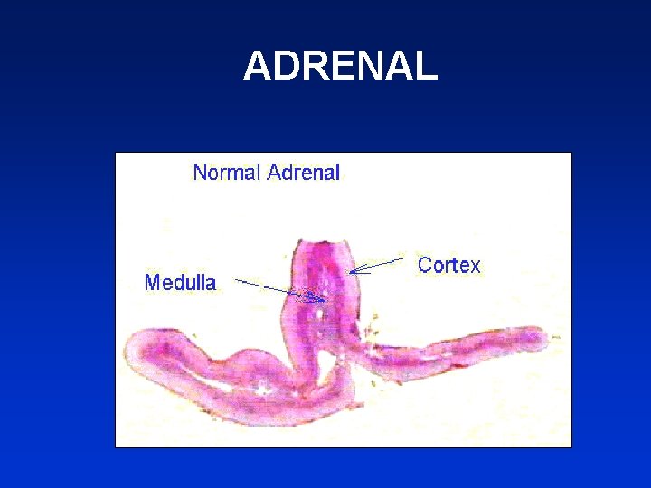 Patologia da Adrenal ADRENAL ADRENAL ADRENAL ADRENAL ADRENAL