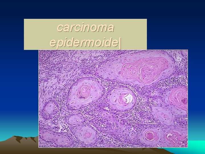 NEOPLASIA Dra Sundry Durn B Hospital Max Peralta