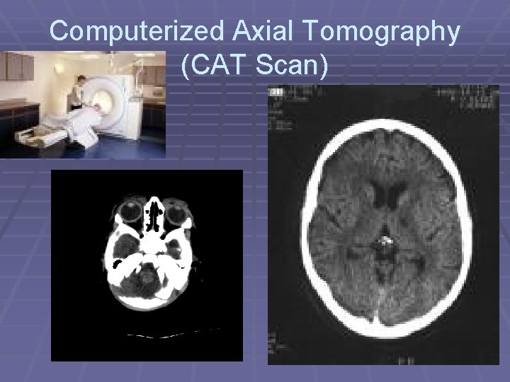 Neurological Disorders PSY 417 Schuetze Diagnosing Neurological Problems