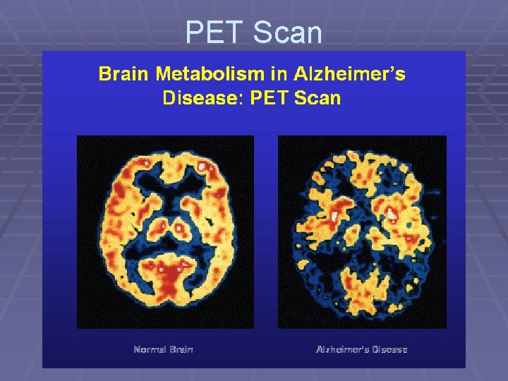 Neurological Disorders PSY 417 Schuetze Diagnosing Neurological Problems