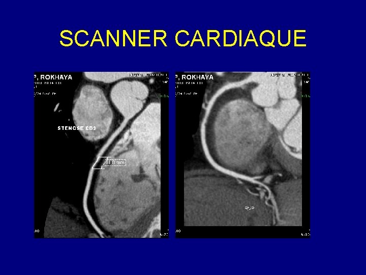 IMAGERIE DU THORAX Dr A R NDIAYE HPD