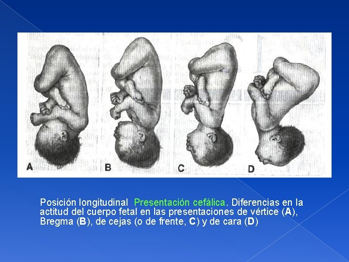 Mvil Fetal Cabeza Suturas Fontanelas Antropometra fetal Colocacin