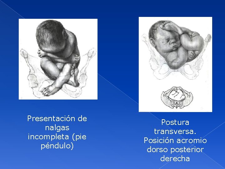 Mvil Fetal Cabeza Suturas Fontanelas Antropometra fetal Colocacin