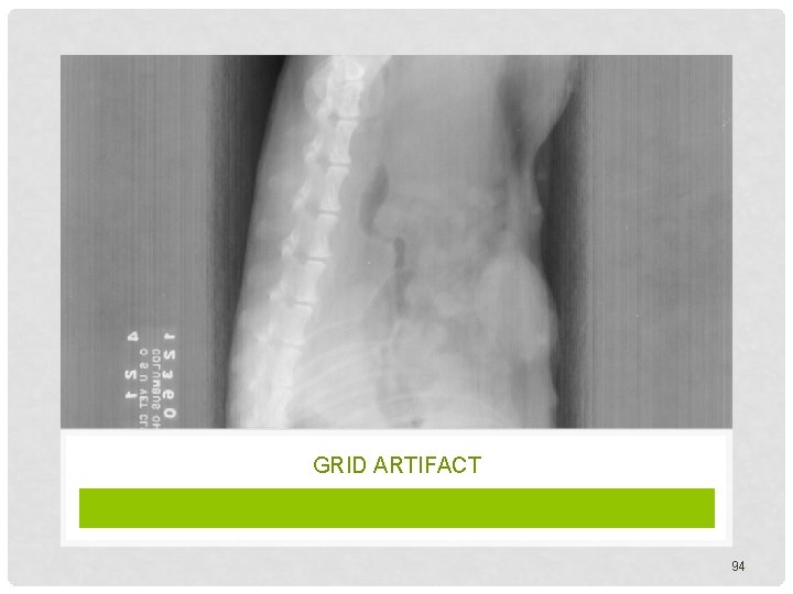 IMAGE QUALITY AND ARTIFACTS 1 WHY YOU SEE