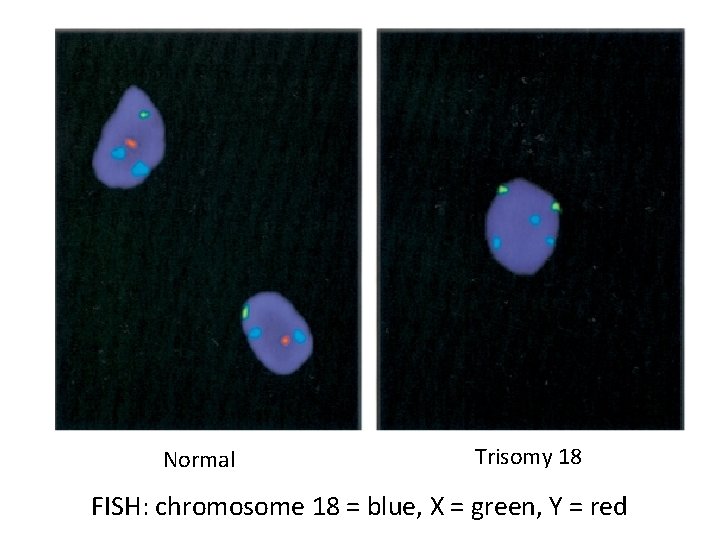 Genetic Tests Oral Histology Kristine Krafts M D