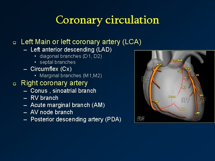 Localization of culprit artery in STEMI Dr Bijilesh