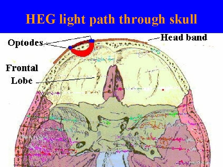 How to Make HEG Work What is HEG