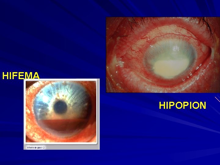 EXPLORACIN DEL PACIENTE OFTALMOLGICO ANAMNESIS EXAMEN SUBJETIVO EXAMEN