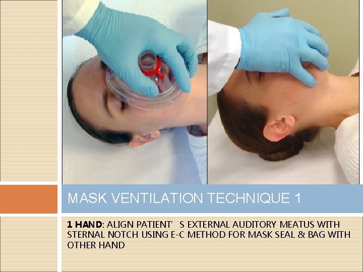 THE DIFFICULT AIRWAY MANAGEMENT IN ADULT CRITICAL CARE
