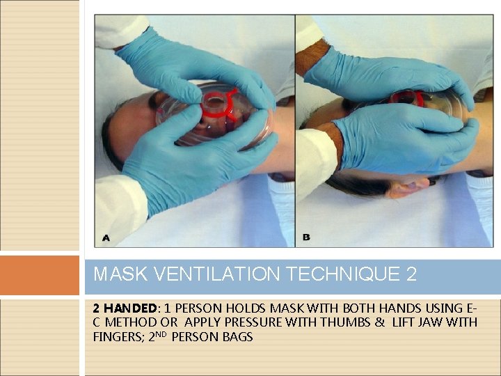 THE DIFFICULT AIRWAY MANAGEMENT IN ADULT CRITICAL CARE