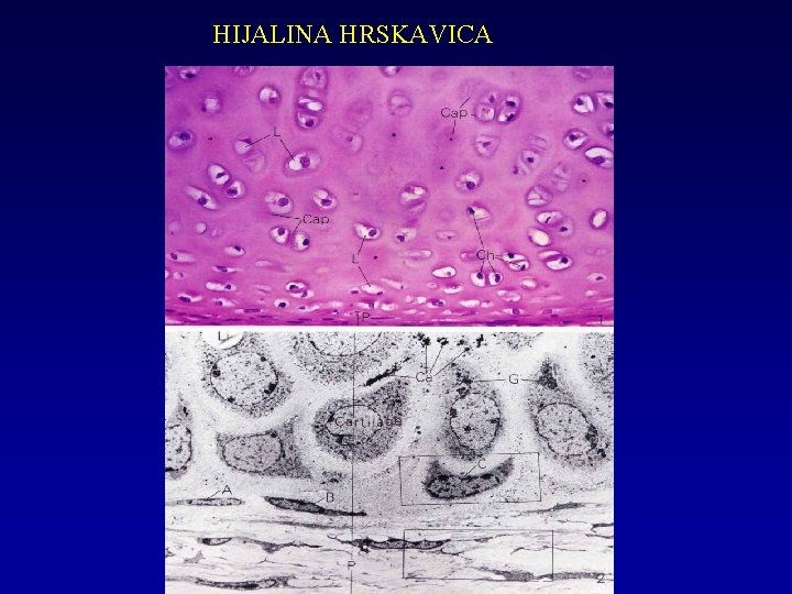 HRSKAVINO TKIVO Poseban oblik vezivnog tkiva s vsrtom