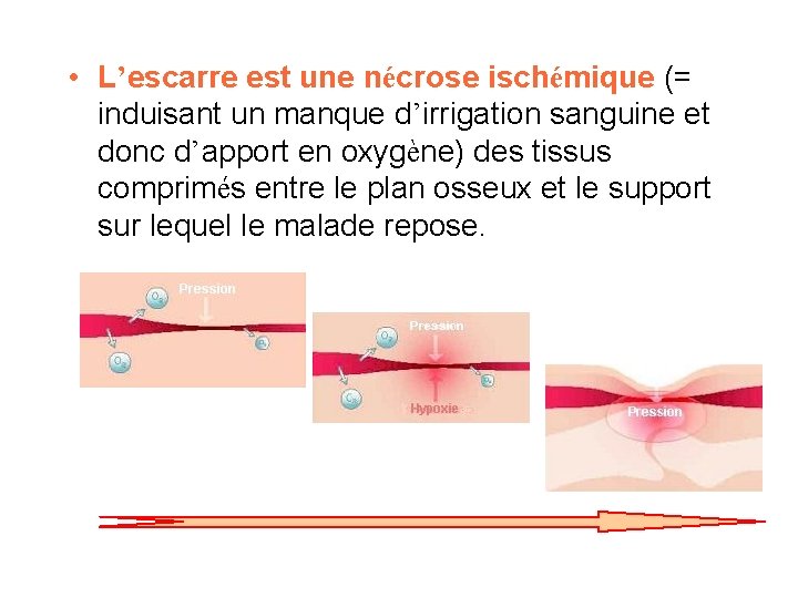 LES ESCARRES tudiants infirmiers Promotion 2011 2012 Laurence